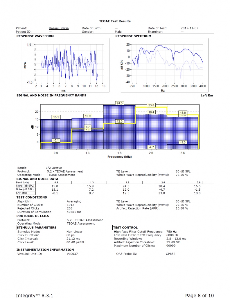 گسیل‌ های صوتی گذرای گوش (TEOAE) - کلینیک الوند